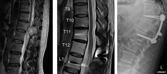 Surgery for Brain and Spine Tumors in Boise, ID | Kelly Bridges ...
