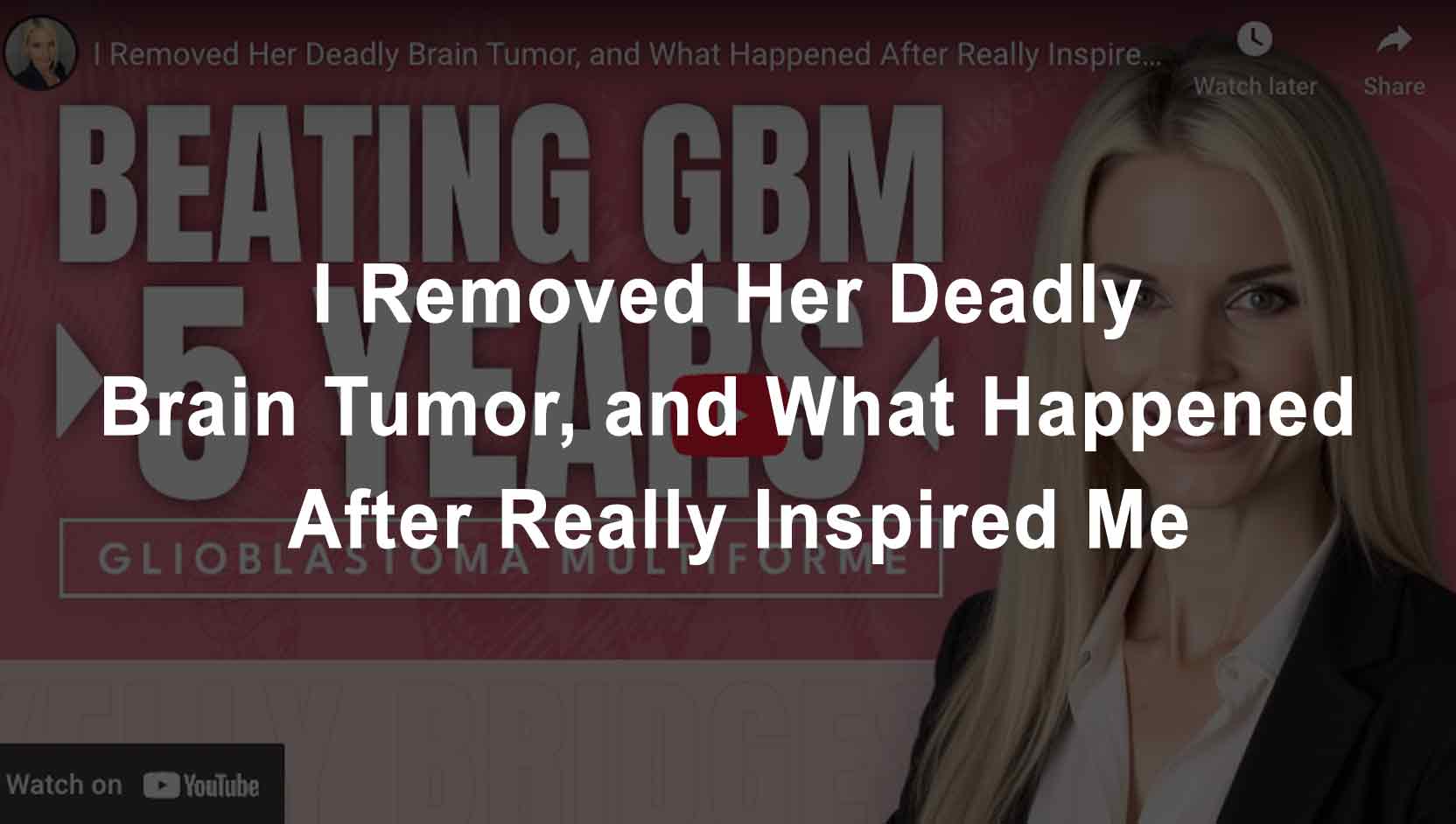 I Removed Her Deadly Brain Tumor, and What Happened After Really ...