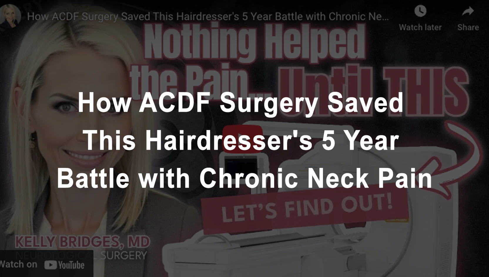 How ACDF Surgery Saved This Hairdresser's 5 Year Battle with Chronic ...