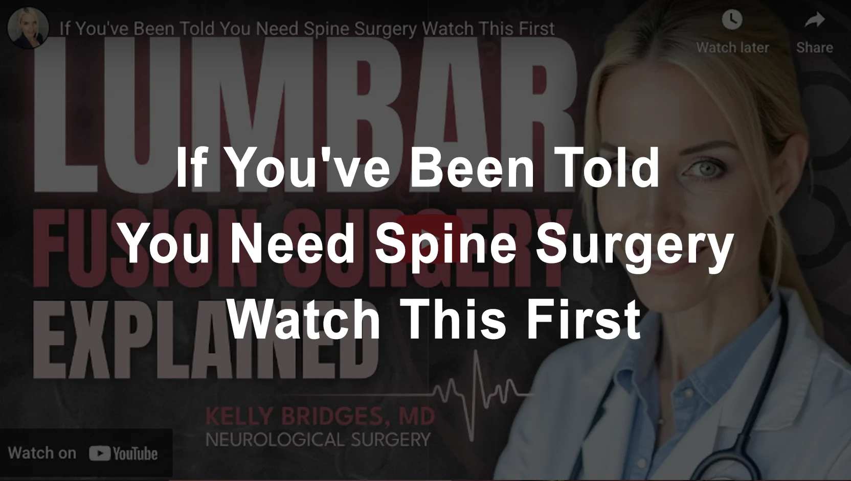 If You've Been Told You Need Spine Surgery Watch This First - Kelly ...